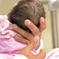 Síndrome de Edwards: Principais Sintomas e Diagnóstico